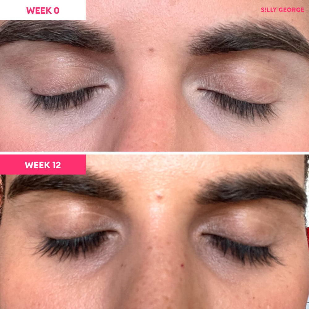 Eyelash Serum That Works | Silly George