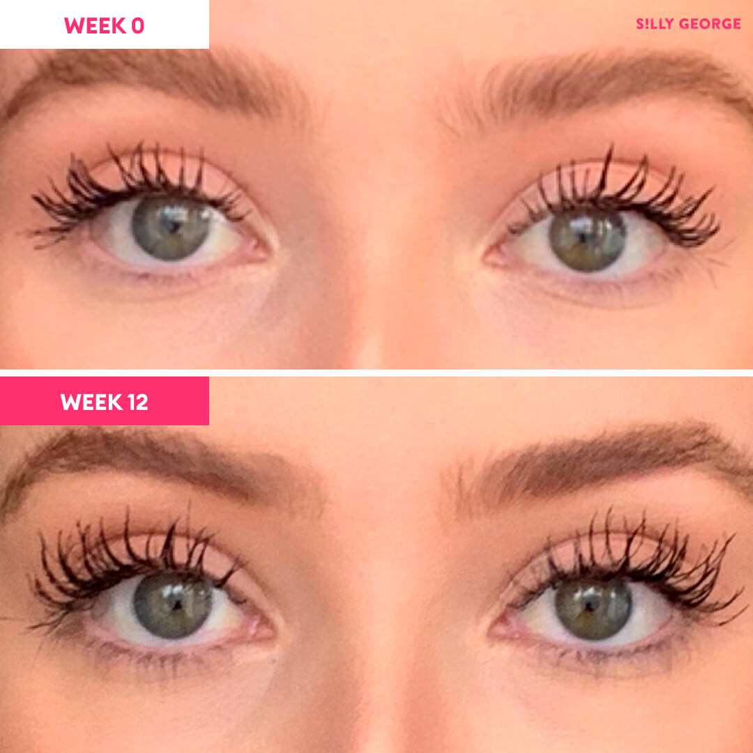 Eyelash Serum That Works | Silly George